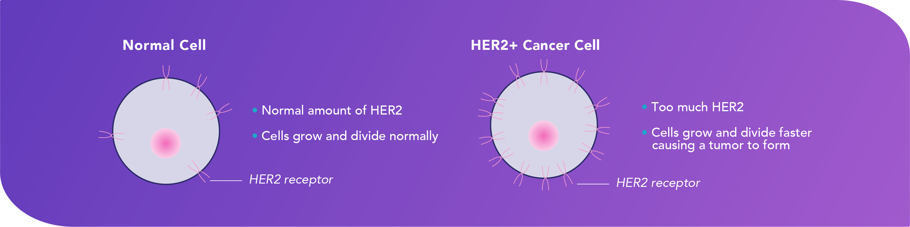 What Is HER2+ Early Breast Cancer? | Herceptin® (trastuzumab)