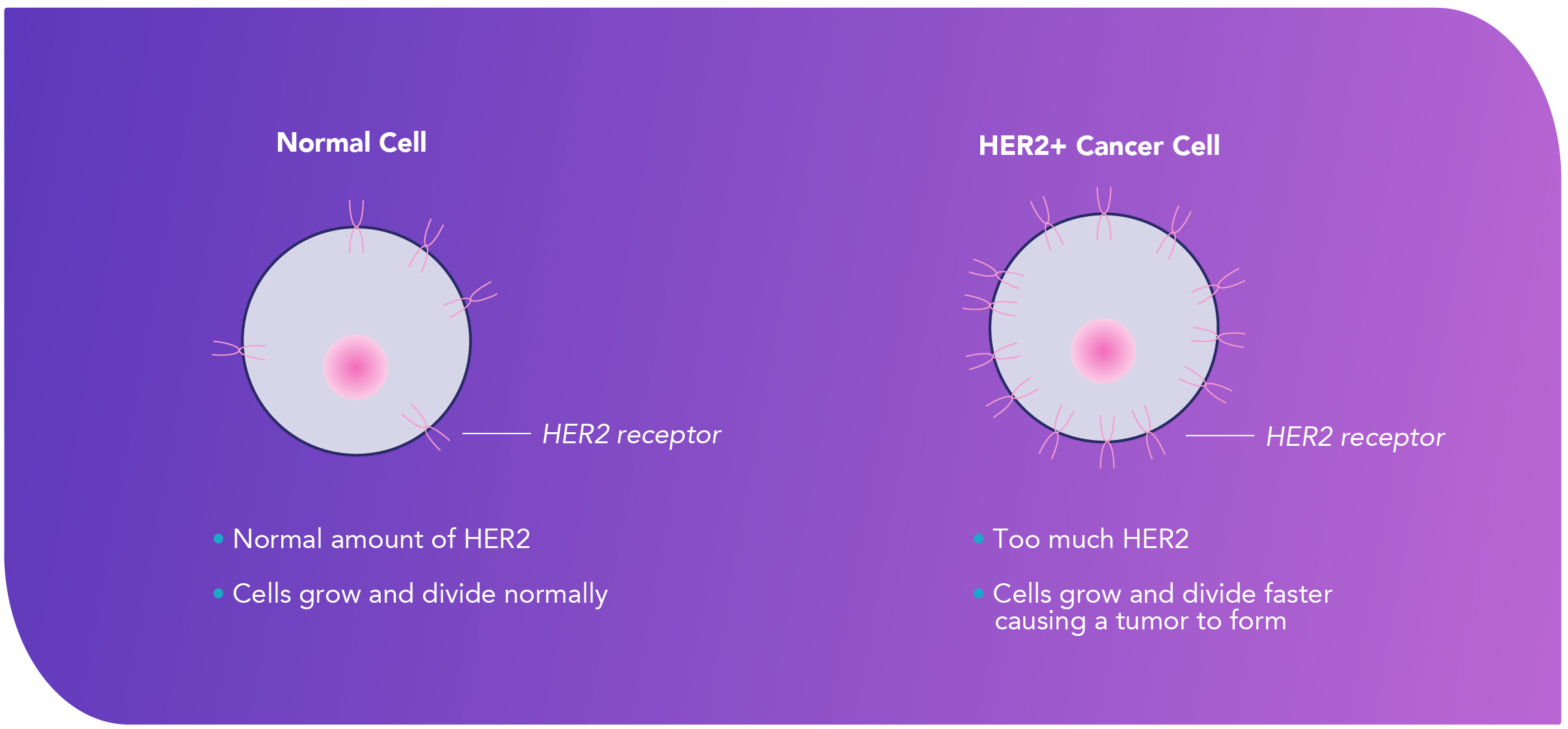 HER2+ Metastatic Stomach Cancer | Herceptin® (trastuzumab)